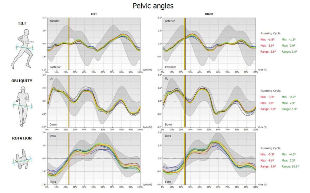 Gait Analysis - MyoMax Performance